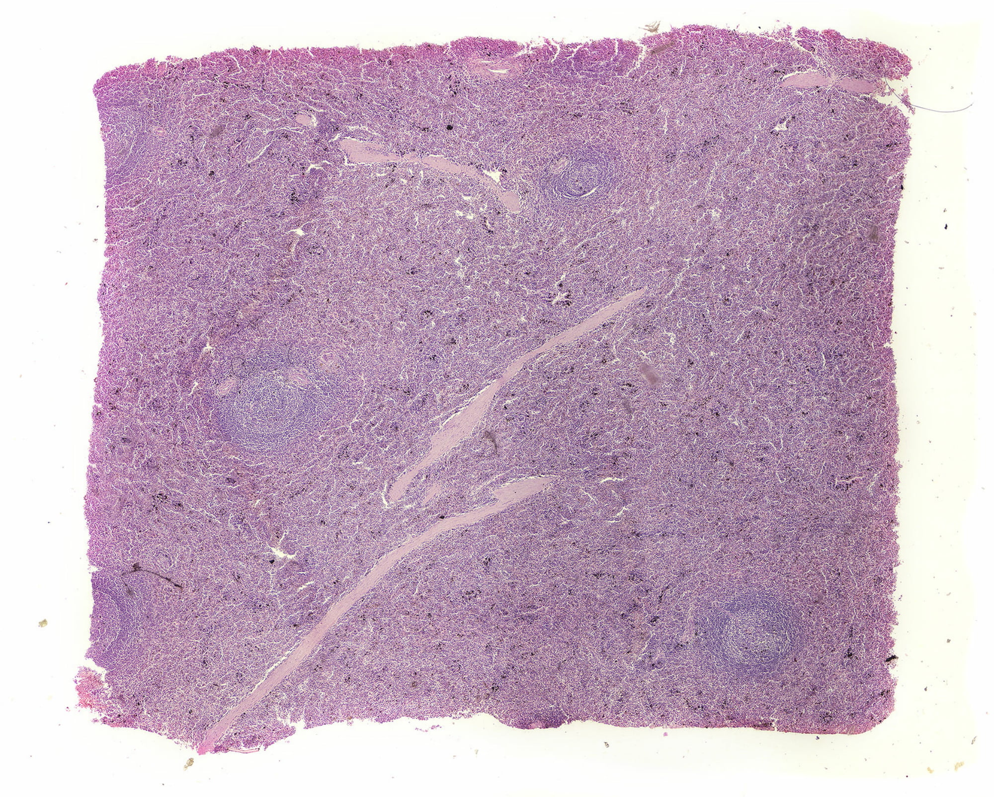 Microscopy Example: Malaria